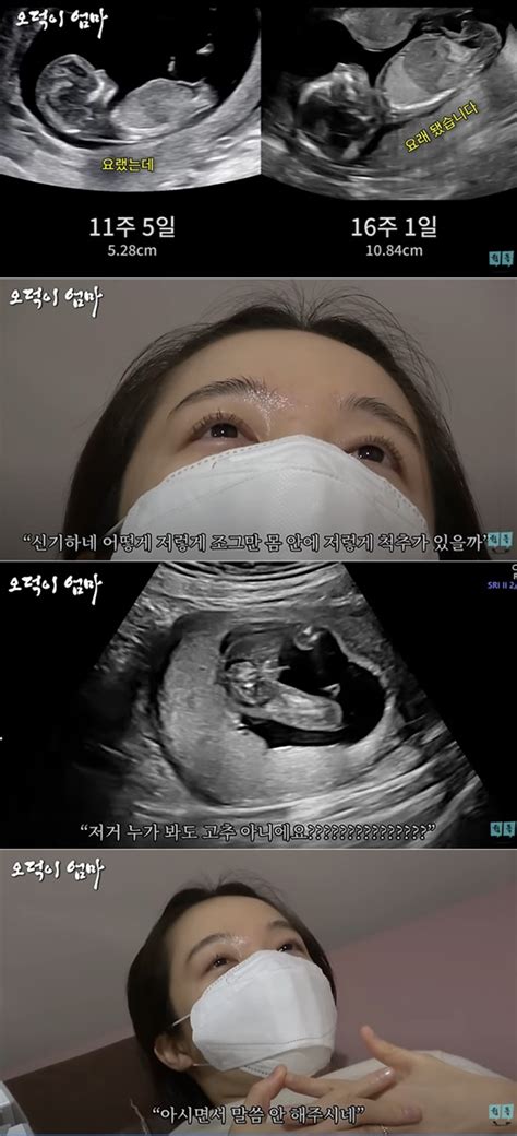 시험관만 4번 황보라 난임 극복 예비맘 설레발…누가 봐도 아들 나무뉴스