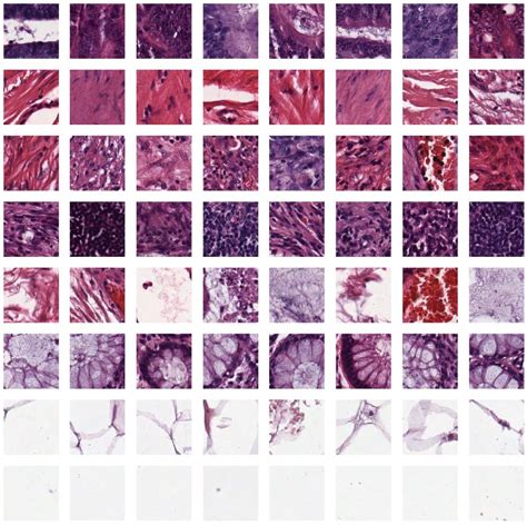 Deep Transfer Learning For Texture Classification In Colorectal Cancer