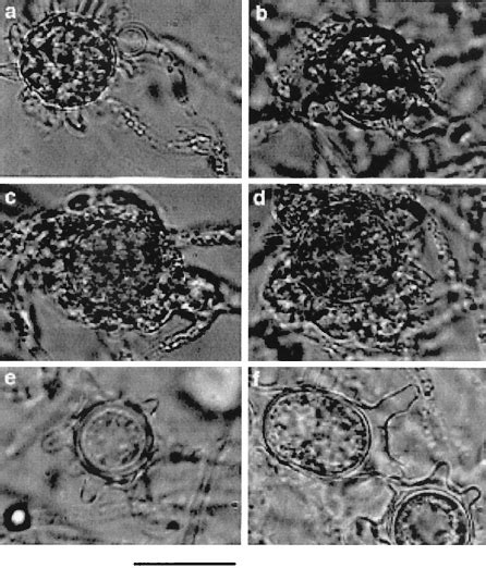 Reproductive Structures Of Pythium Regulare A Ornamented Oogonia With Download Scientific