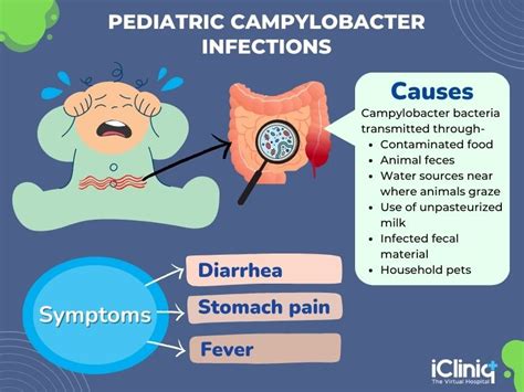 What Is Pediatric Campylobacter Infection