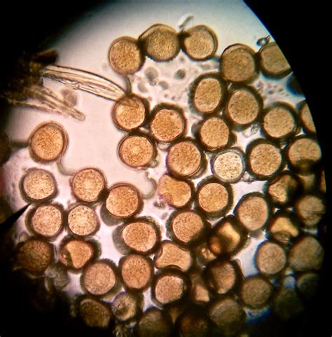 Southern Vs Common Rust In Corn Jenresources