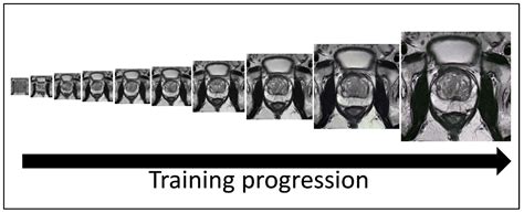jpm free full text generative adversarial networks can create high