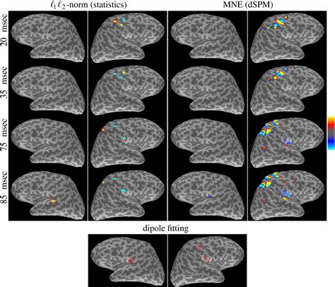 Figure 7 From A Distributed Spatio Temporal Eegmeg Inverse Solver Semantic Scholar
