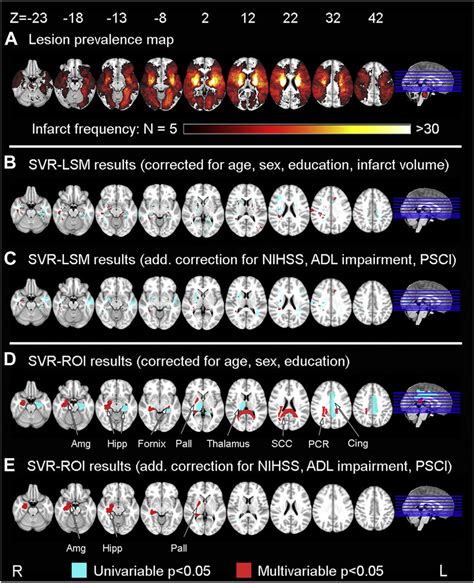 Lesion Prevalence Map And Lesionsymptom Mapping Results Results Are