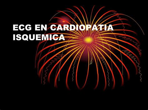 Ecg En Cardiopatia Isquemica María Ibarria Udocz
