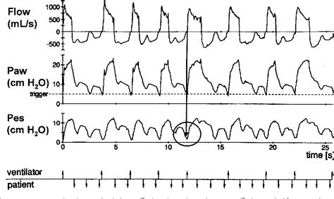 Bufferbloat Waveform