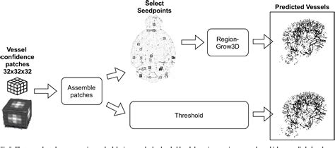Figure 7 From U Net Based Vessel Segmentation For Murine Brains With Small Micro Magnetic