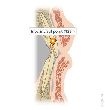 Interincisal Point 135° E Anatomy Imaios