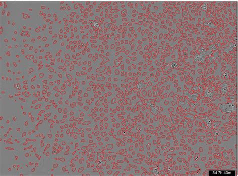 Brightfield Cell Counting Image Analysis Image Sc Forum