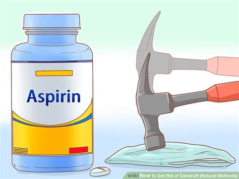 3 Ways To Get Rid Of Dandruff Natural Methods WikiHow