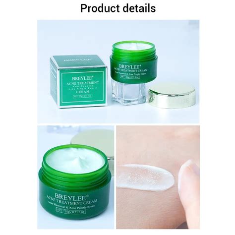 BREYLEE Acne Treatment Cream