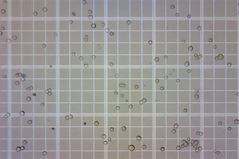 Cells On A Hemocytometer Cells That Are Blue Are Dead Cel… Flickr