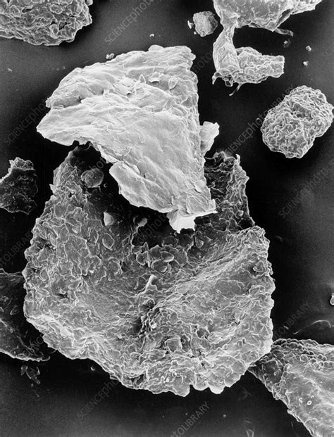 Dandruff Flakes Microscope When Cold Weather Goes But The Flakes