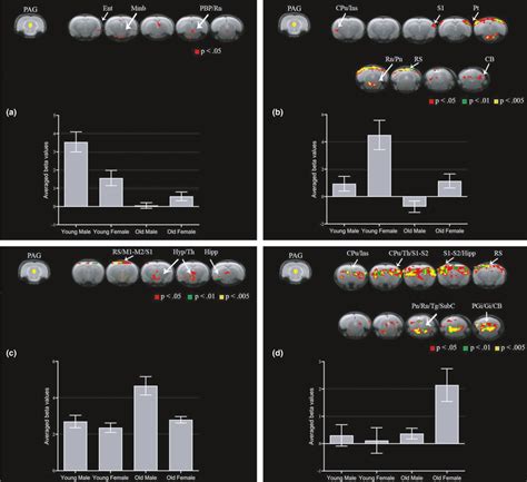 Sex And Age Differences In Pag Connectivity To The Whole Brain At