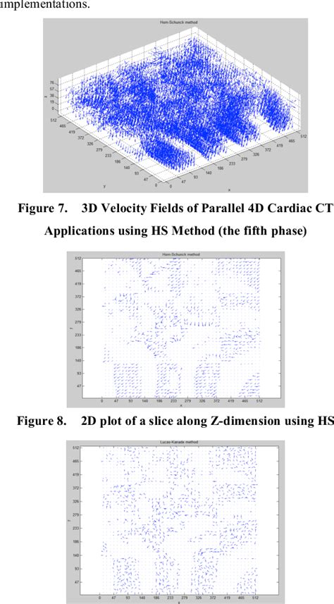Figure 1 From Parallel Optical Flow Processing Of 4d Cardiac Ct Data On Multicore Clusters