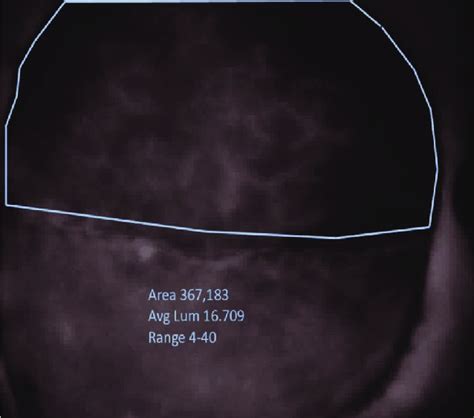 Example Of Polygon Creation To Evaluate Flap Surface Area And Download Scientific Diagram
