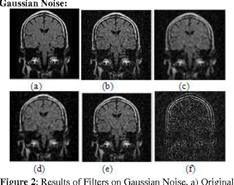 Figure 2 From Comparative Analysis Of Various Denoising Techniques For Mri Images Semantic Scholar