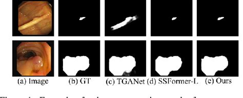 Figure 1 From Sub Band Based Attention For Robust Polyp Segmentation