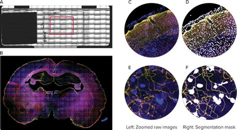 Automated Slide Scanning Of Histologically Stained And Fluorescently
