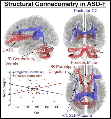 Sex Related Brain Connectivity Correlates Of Compensation In Adults With Autism Insights Into