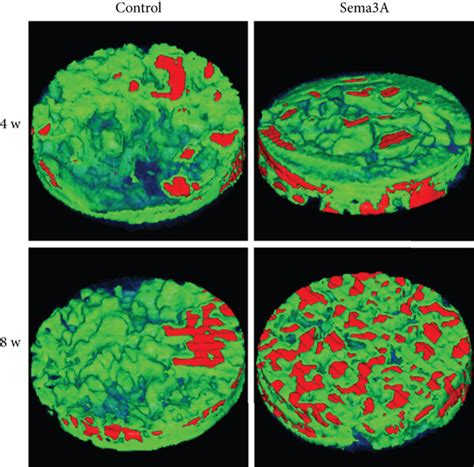 Micro Ct Evaluation Of The Control Group And The Sema3a Group A Download Scientific Diagram