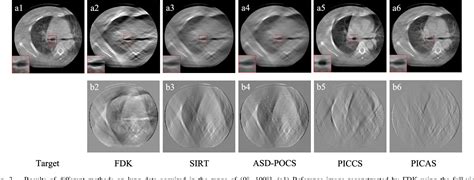 Figure 1 From Prior Image Constrained Iterative Reconstruction With