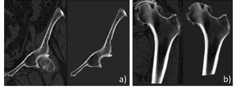 Example Of Reconstructed Intensities After Encoding With Bernstein Download Scientific Diagram