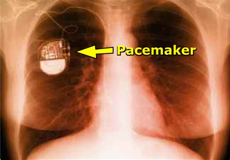 Various Minor Graphical Issues Issue 24 Ruffle Rs Ruffle GitHub