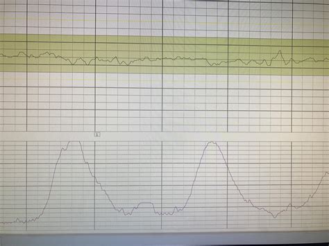 3951 Best R Predaddit Images On Pholder 13 Weeks And A Girl Were So Excited Greetings To