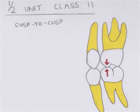 Orthdontics Flashcards Quizlet