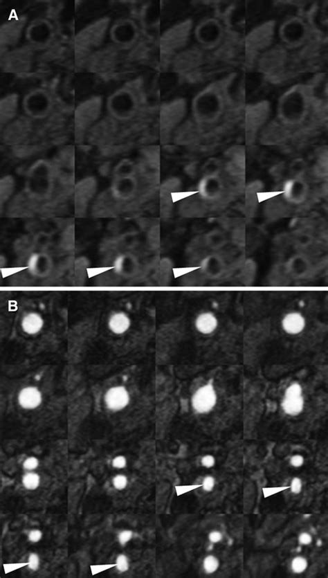 Age Specific Sex Differences In Magnetic Resonance Imaging Depicted