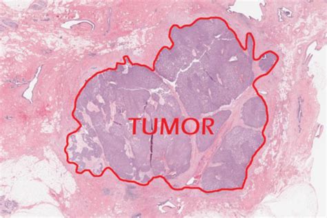 Digital Pathology Place Blog Podcast Webinar Events