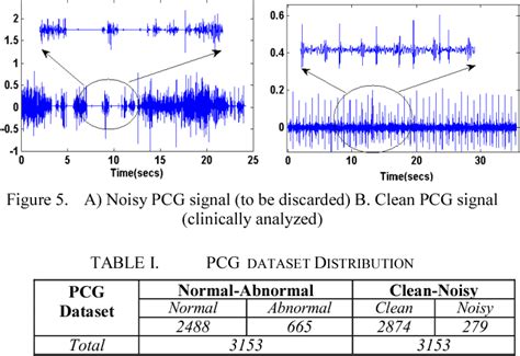 Figure 5 From Analysis Of Phonocardiogram Signals Through Proactive Denoising Using Novel Self