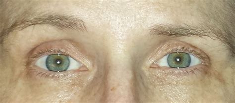 Ask Julie Fast Come On Can You Really Tell You Are Manic By Looking