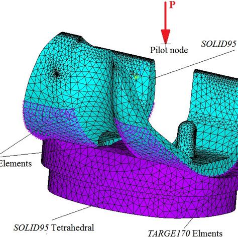 Finite Element Model Of Prosthesis [2] Download Scientific Diagram