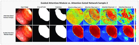 the attention visualization comparison attention gated network vs