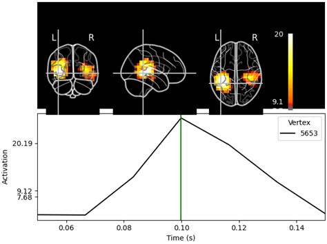 Visualize Source Time Courses Stcs — Mne 1101 Documentation
