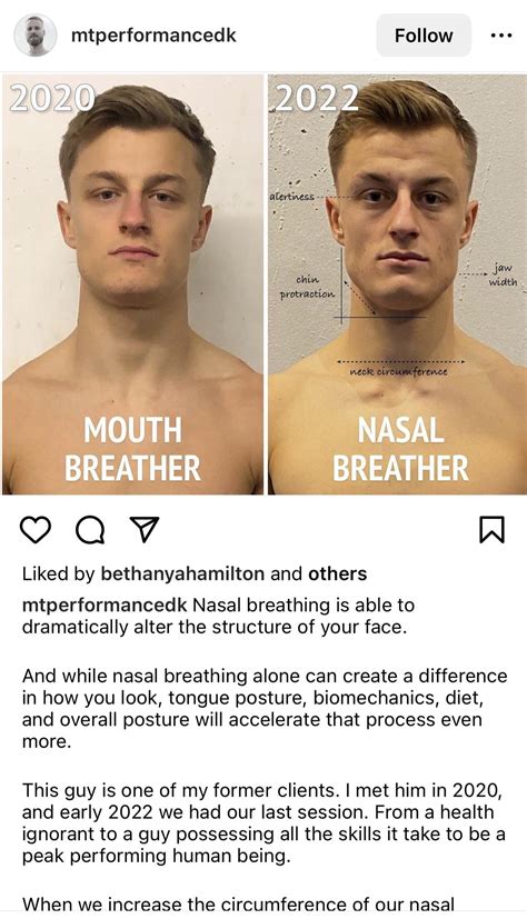 Mouth Breather