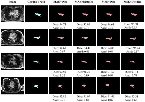 Exemplar Segmentation Results Using Different Combination Loss