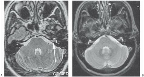Spin Echo Sequence Diagram Pastorhm