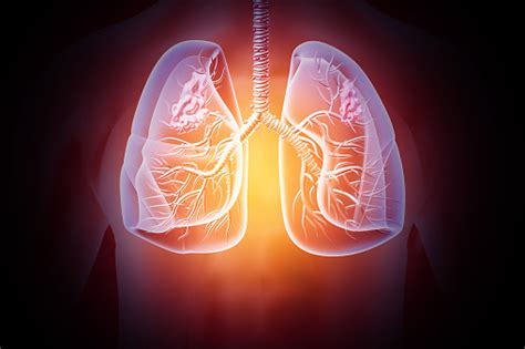 만성 폐쇄성 폐 질환 호흡기 질환 3d 일러스트 레이 션 인체에 대한 스톡 사진 및 기타 이미지 인체 호흡계통 3차원 형태 Istock