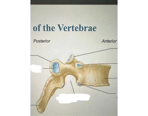 Thoracic Vertabrae Lateral View Quiz