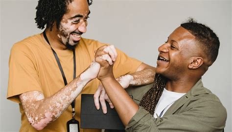 Vitiligo Types Causes Symptoms Treatment Of Leukoderma Or White Leprosy Health