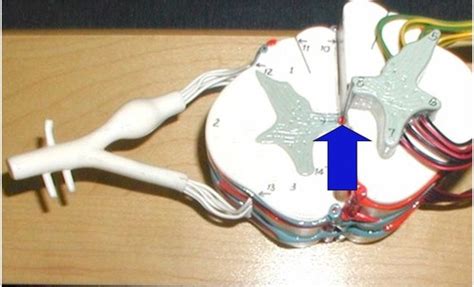 BIOL 2404 Lab Exam II Spinal Cord Plexus Flashcards Quizlet