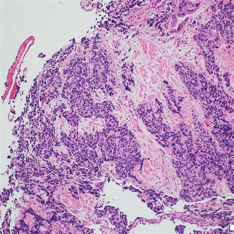 Synaptophysin Staining Download Scientific Diagram