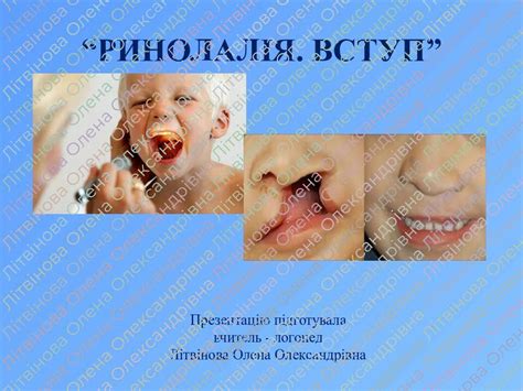 Презентація на тему "Ринолалія" | Презентація. Логопед