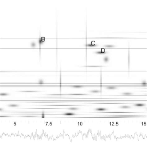Time Frequency Energy Distribution Equation 12 Of 20 Seconds Of Sleep Download Scientific