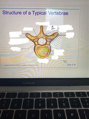 Vertebrae Flashcards Quizlet
