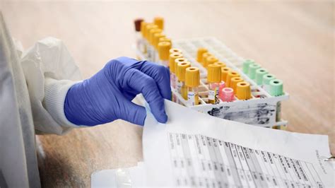 Lactate Dehydrogenase LDH Test Uses And Results