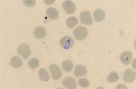 Layer 3 Object Detection Dataset By Malaria Sui